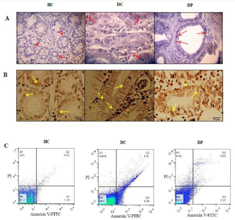 Preventive and Tumor-Suppressive Effects of Lactobacillus Paracasei X12 ...