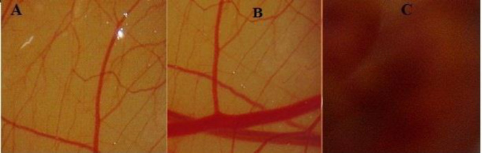 Improvement of Ocular Efficacy of Levofloxacin by Bioadhesive Chitosan ...