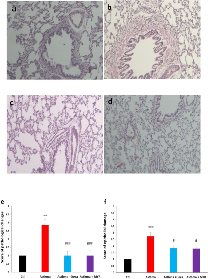 Anti-Inflammatory and Anti-Oxidative Effects of Myrtenol in the Rats ...