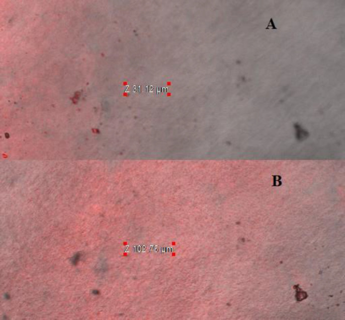 Improvement of Ocular Efficacy of Levofloxacin by Bioadhesive Chitosan ...