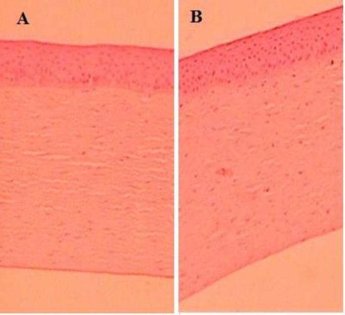 Improvement of Ocular Efficacy of Levofloxacin by Bioadhesive Chitosan ...
