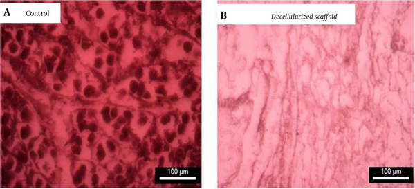 Evaluating the Biocompatibility of Decellularized Pancreas and Its ...