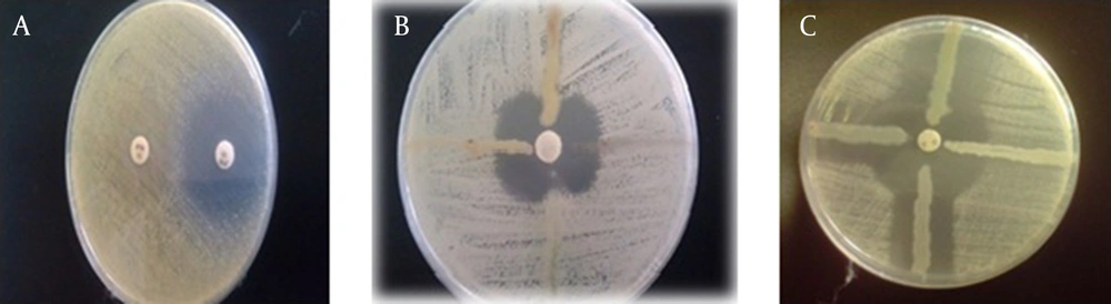 Detection of KPC Carbapenemase in Pseudomonas aeruginosa Isolated From ...