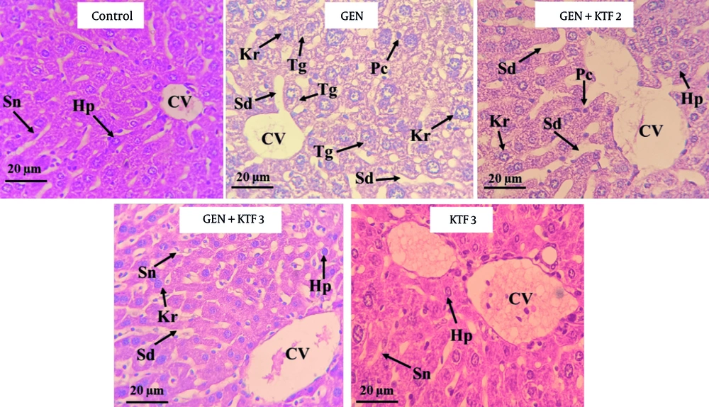 Anti-inflammatory and Antioxidant Effects of Ketotifen Against ...