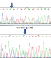 Investigating Skeletal Anomalies (LIFR Gene Mutations) in Three ...